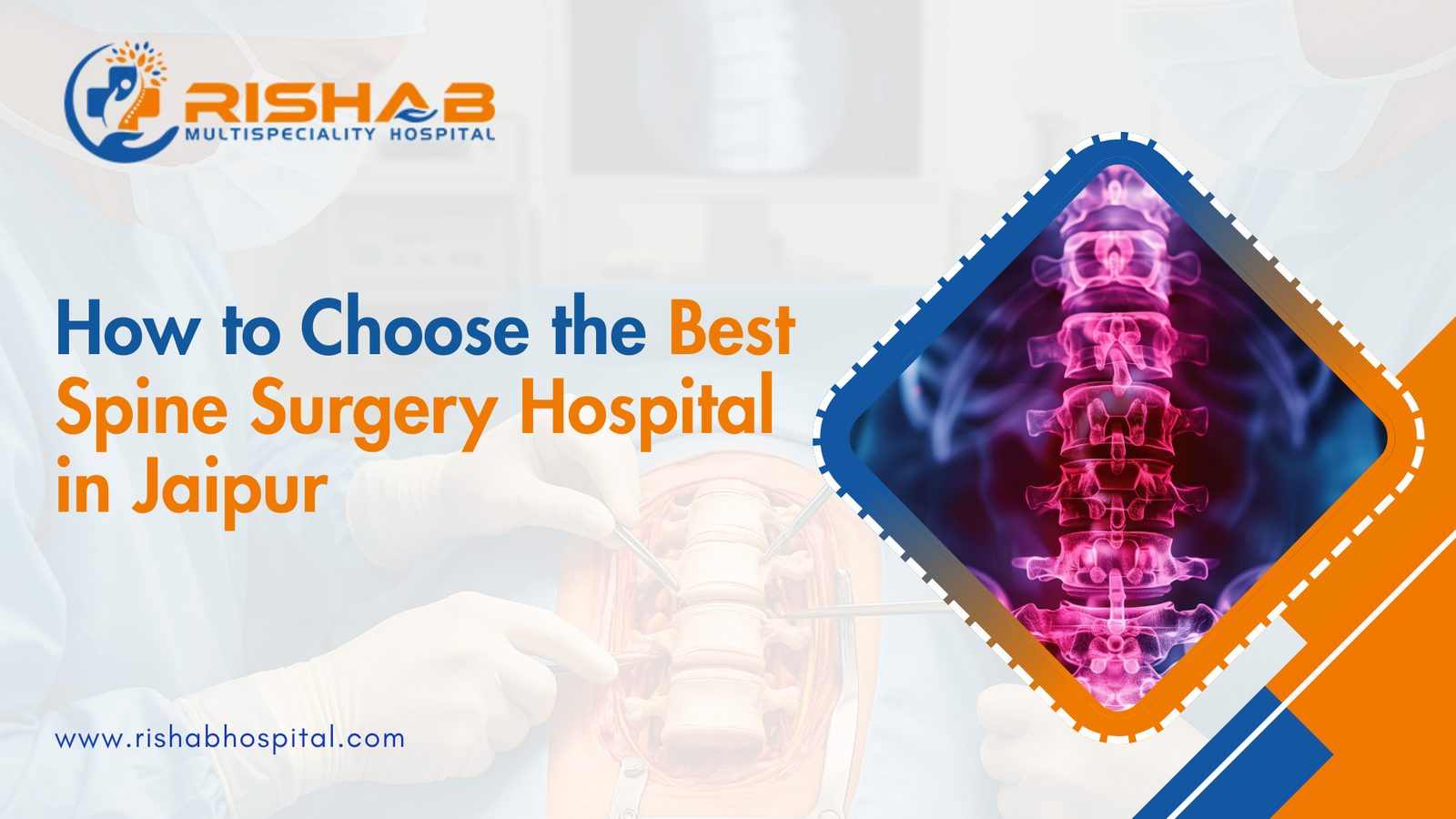 How to Choose the Best Spine Surgery Hospital: 5 Key Factors to Consider